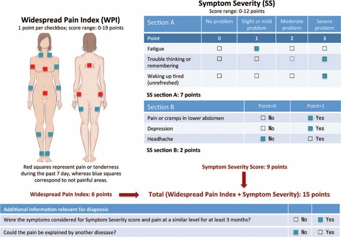 Fibromyalgia Pain — Targeted Treatment of Local Pain Sources